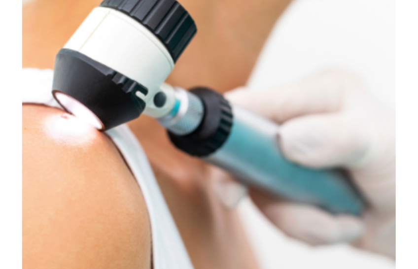 Dermatology | ODE | RCGP Learning